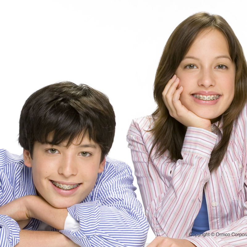 Efficient Damon Self-Ligating Braces | Solas Orthodontics