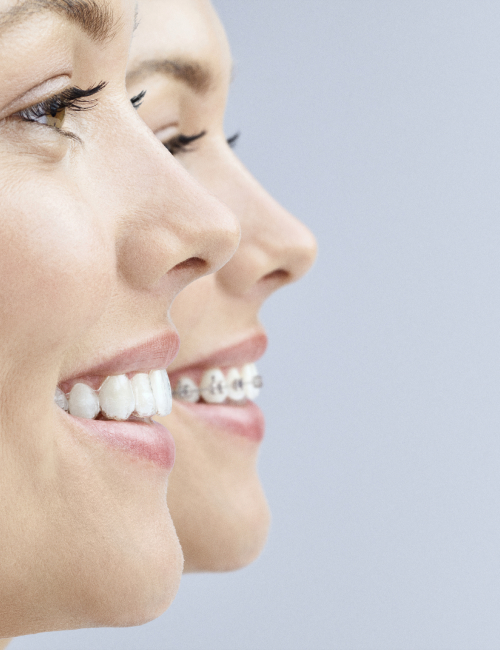 Solas Orthodontics Perth: Your New Smile Starts Here!
