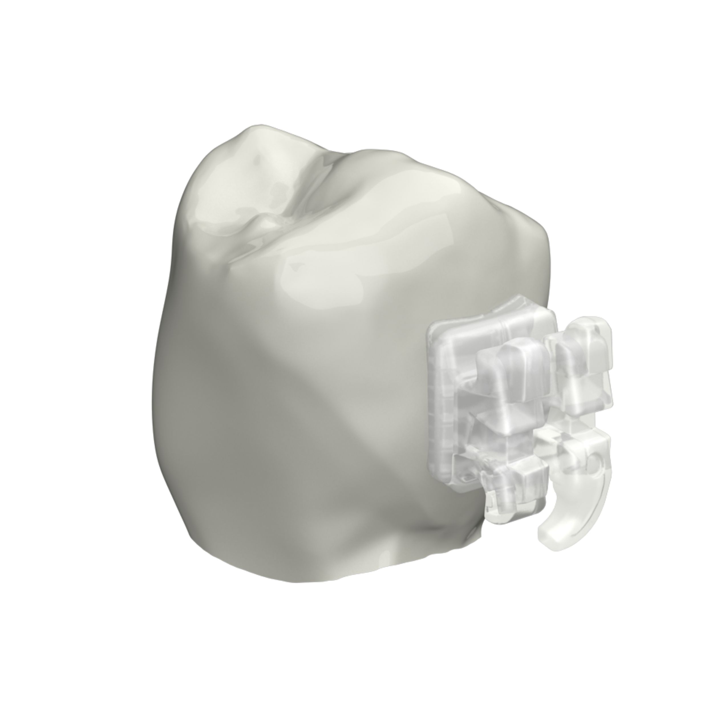 Experience LightForce™ Next-Gen 3D Braces | Solas Orthodontics